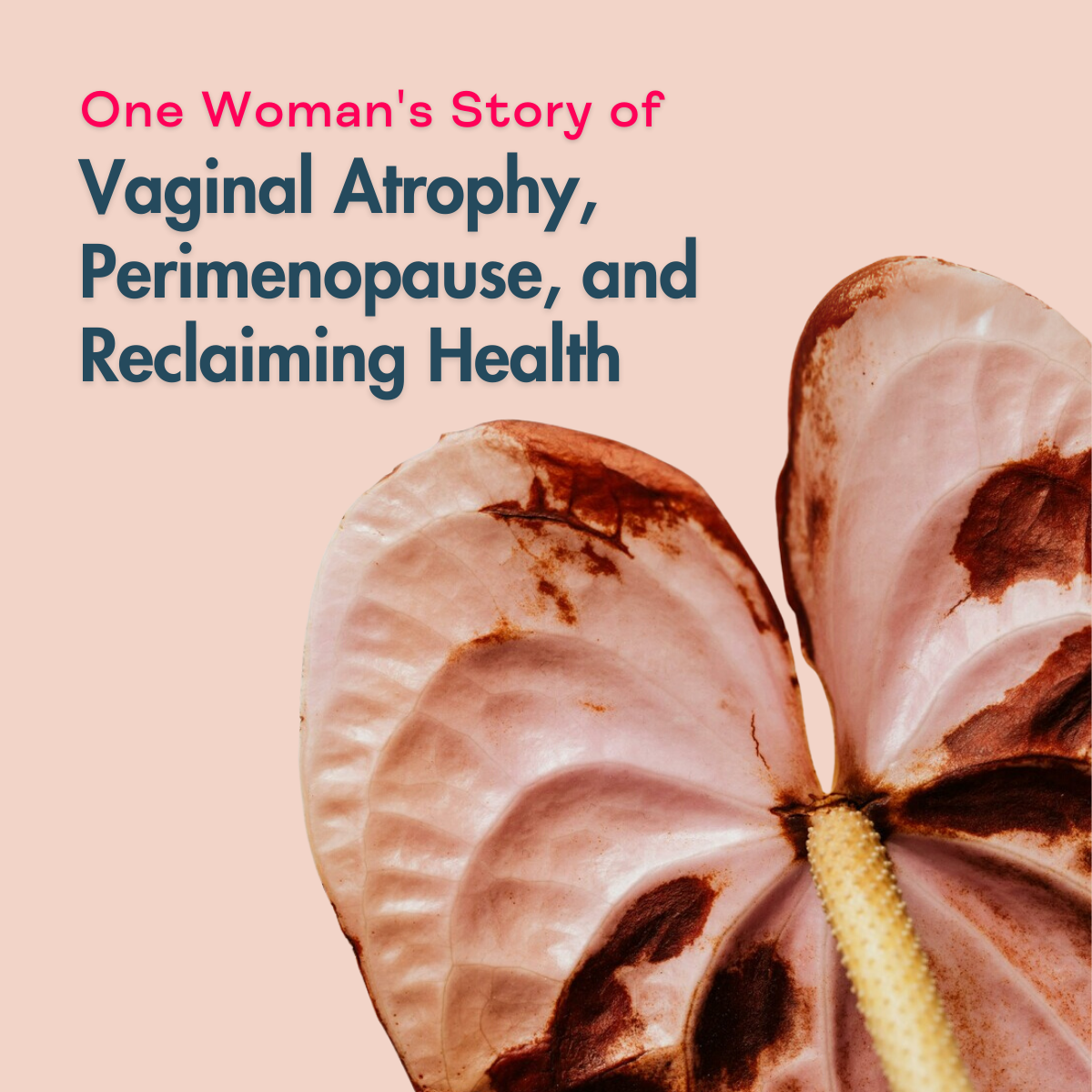 Vaginal atrophy | Nyssa